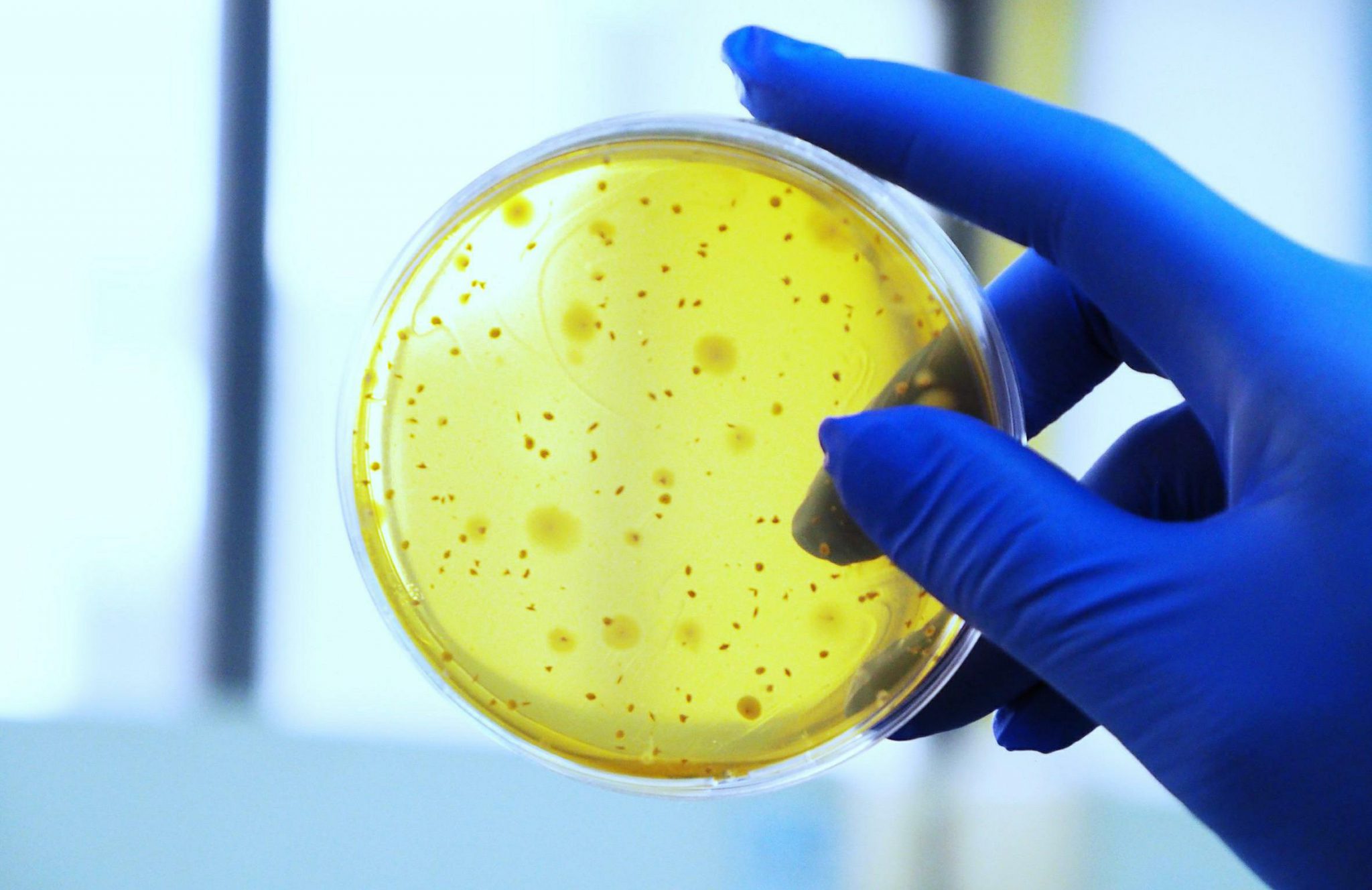 What are the characteristics of standard probiotics? – Live ...